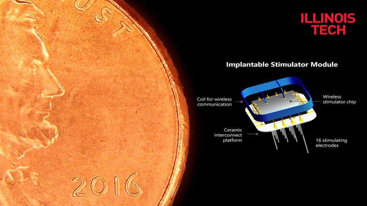 First Successful Implantation of Revolutionary Wireless Visual ...